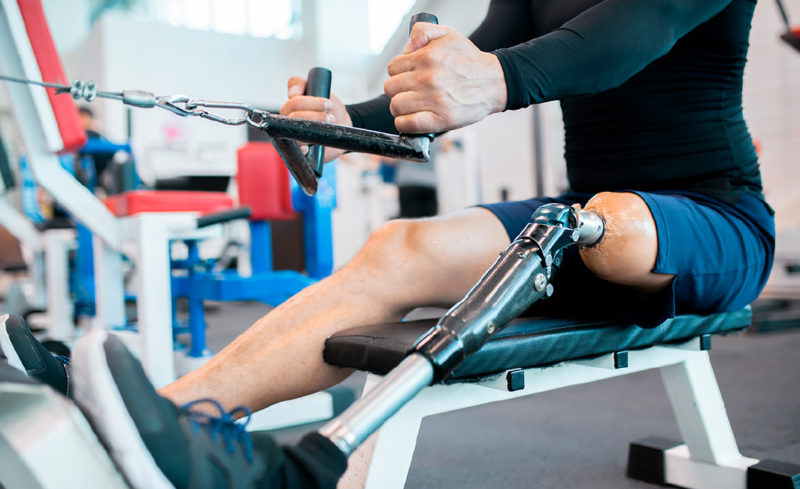 Pròtesis – Ortopèdia Espona